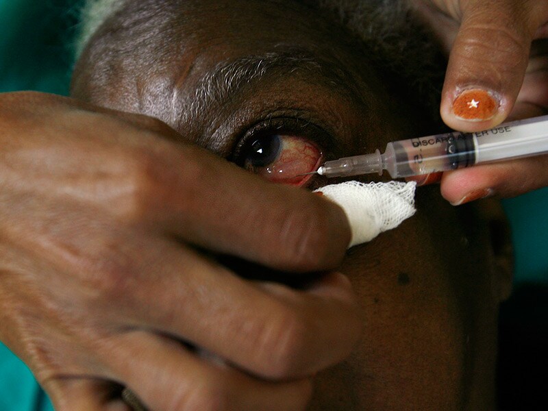 Ranibizumab Holds Visual Line In Real World Study