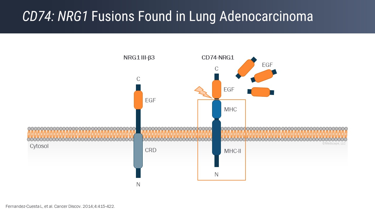 NRG1 Gene Fusion: Unlocking New Pathways of Treatment