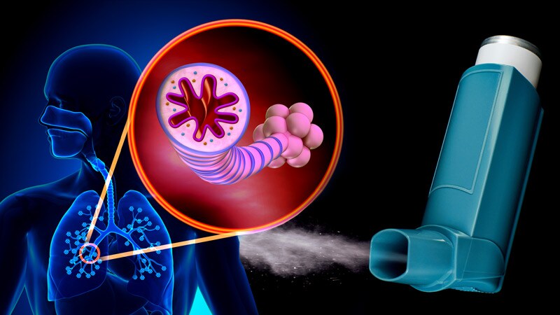 Albuterol: Pharmacokinetics Mechanism Of Action Video, 53% OFF Albuterol: Pharmacokinetics Mechanism Of Action Video, 53% OFF